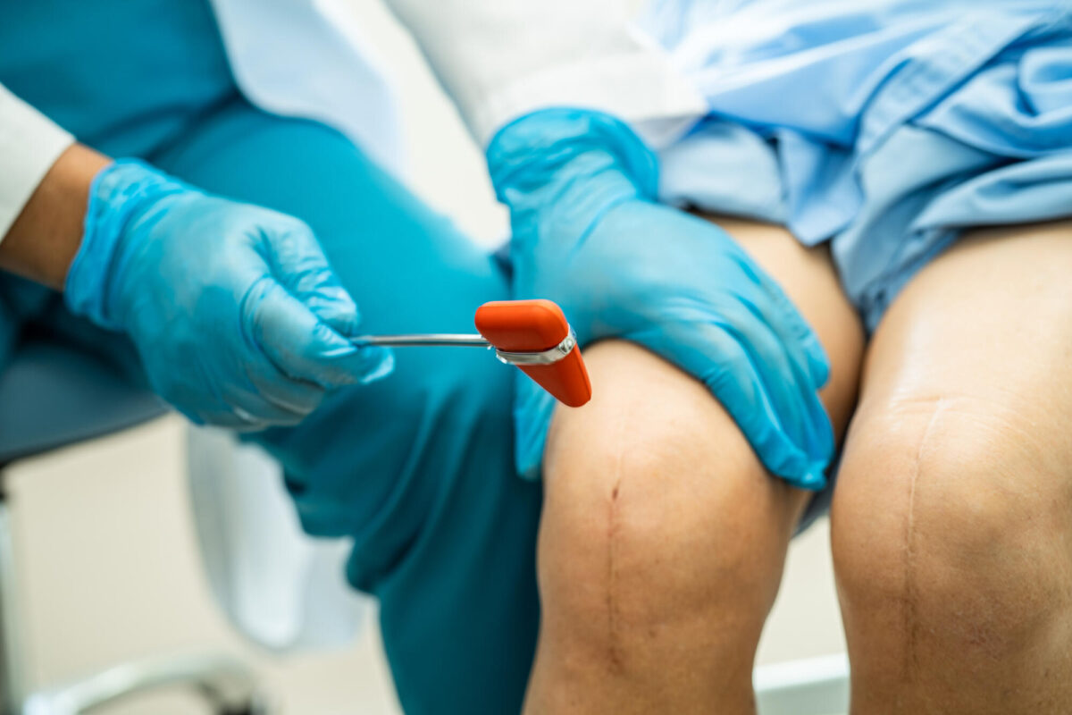 The Road to Recovery: What to Expect After ACL Reconstruction Surgery - Blackrock Orthopedics