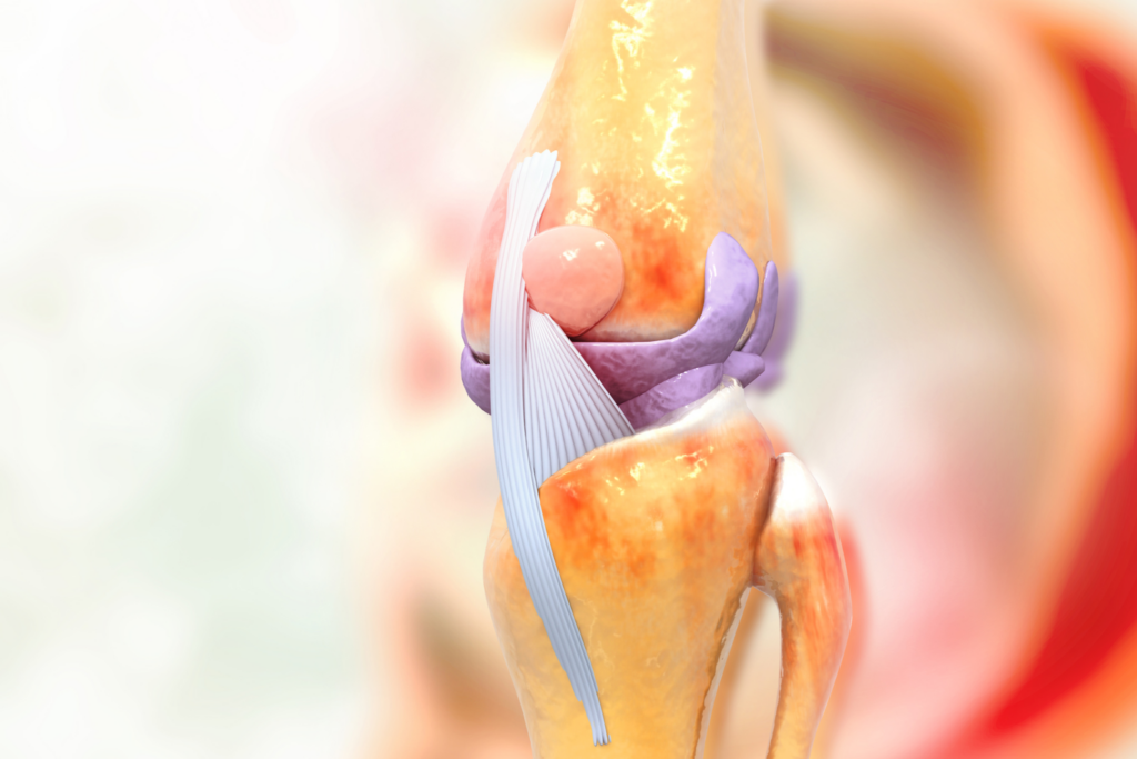 Partial Knee Replacement Recovery: What to Expect - Blackrock Orthopedics